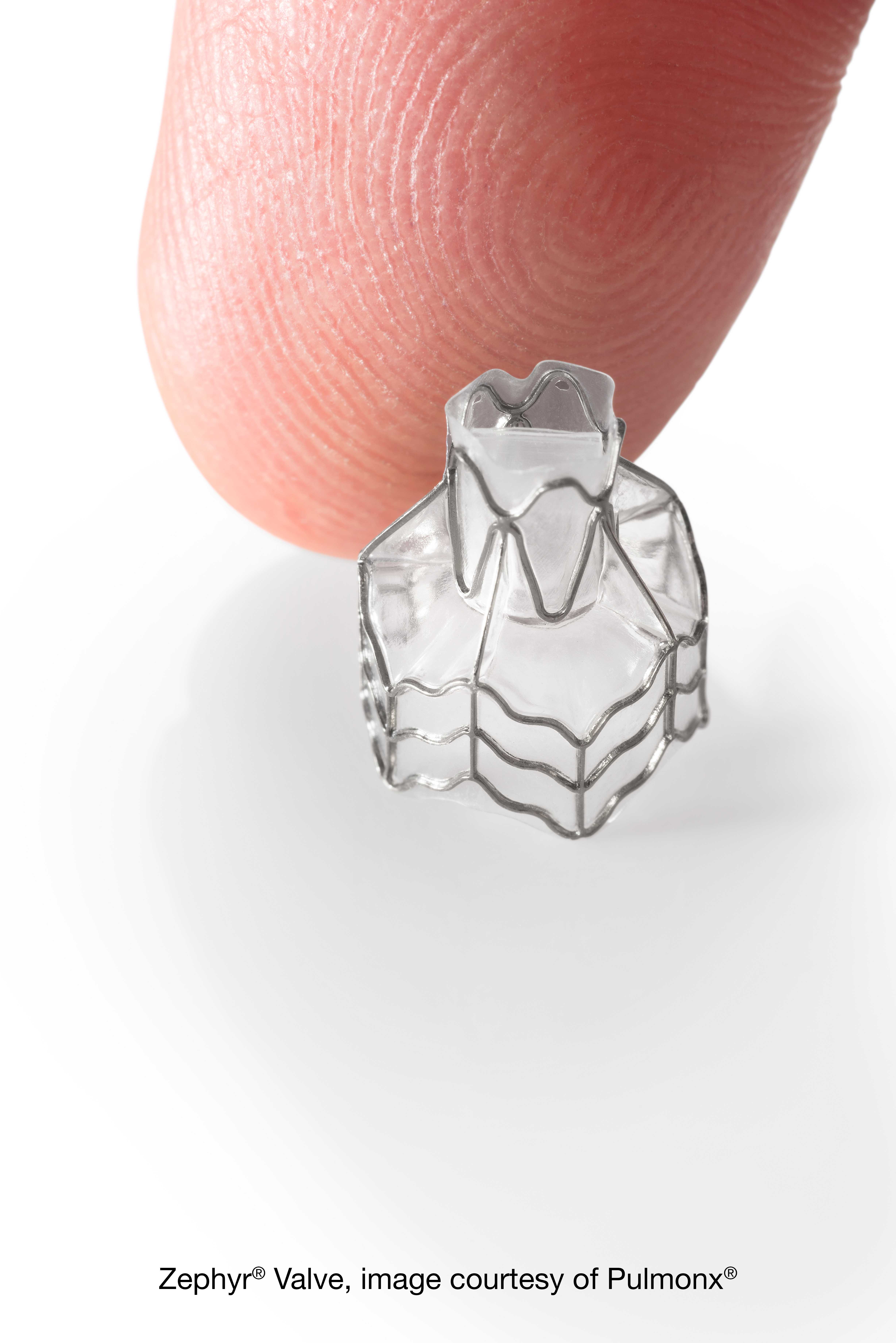 Montefiore Einstein Introduces Groundbreaking Zephyr® Valve ...