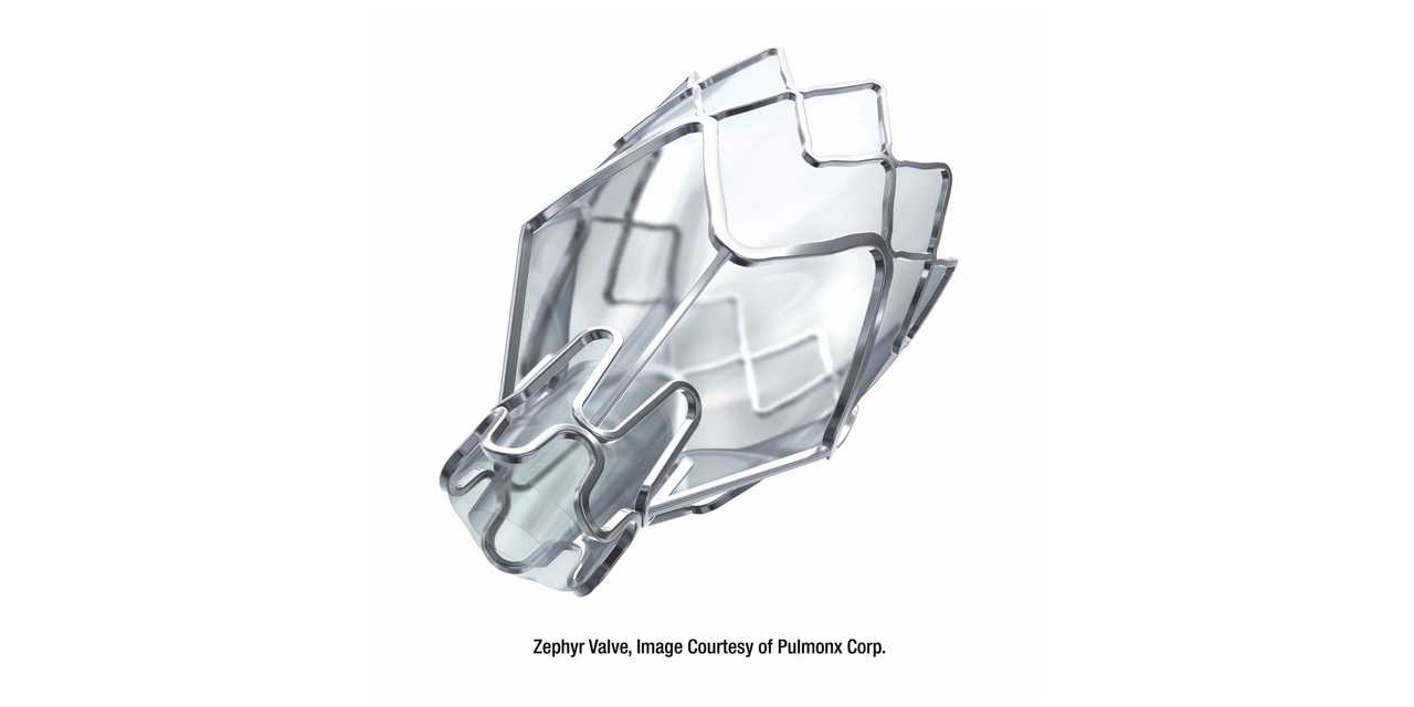 Montefiore Einstein Introduces Groundbreaking Zephyr® Valve ...